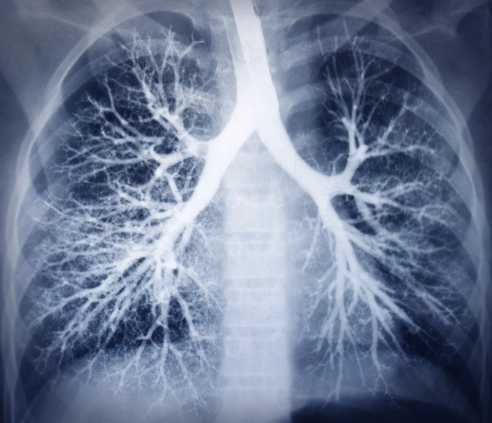 How COPD Changes your Body - Windom Area Health