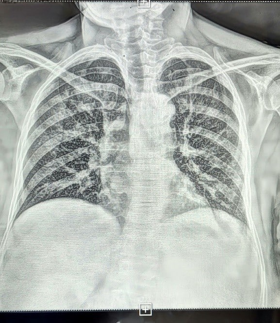 Mobile Digital X-Ray: Improving the Patient Experience - Windom Area Health
